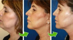 My friend revealed to me a way to get rid of sagging skin. This is how ...